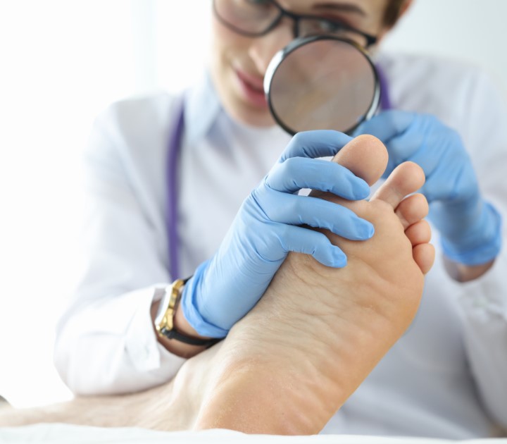 Prevent Stubborn Toenail Fungus This Summer